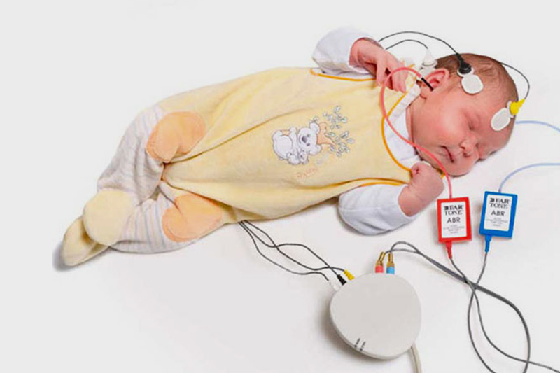 Exame BERA no consultório de fonoaudiologia | Alphafono - Clínica de ...